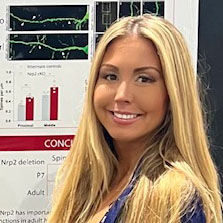 Blanchard Lab | Neuroscience Labs - Icahn School of Medicine